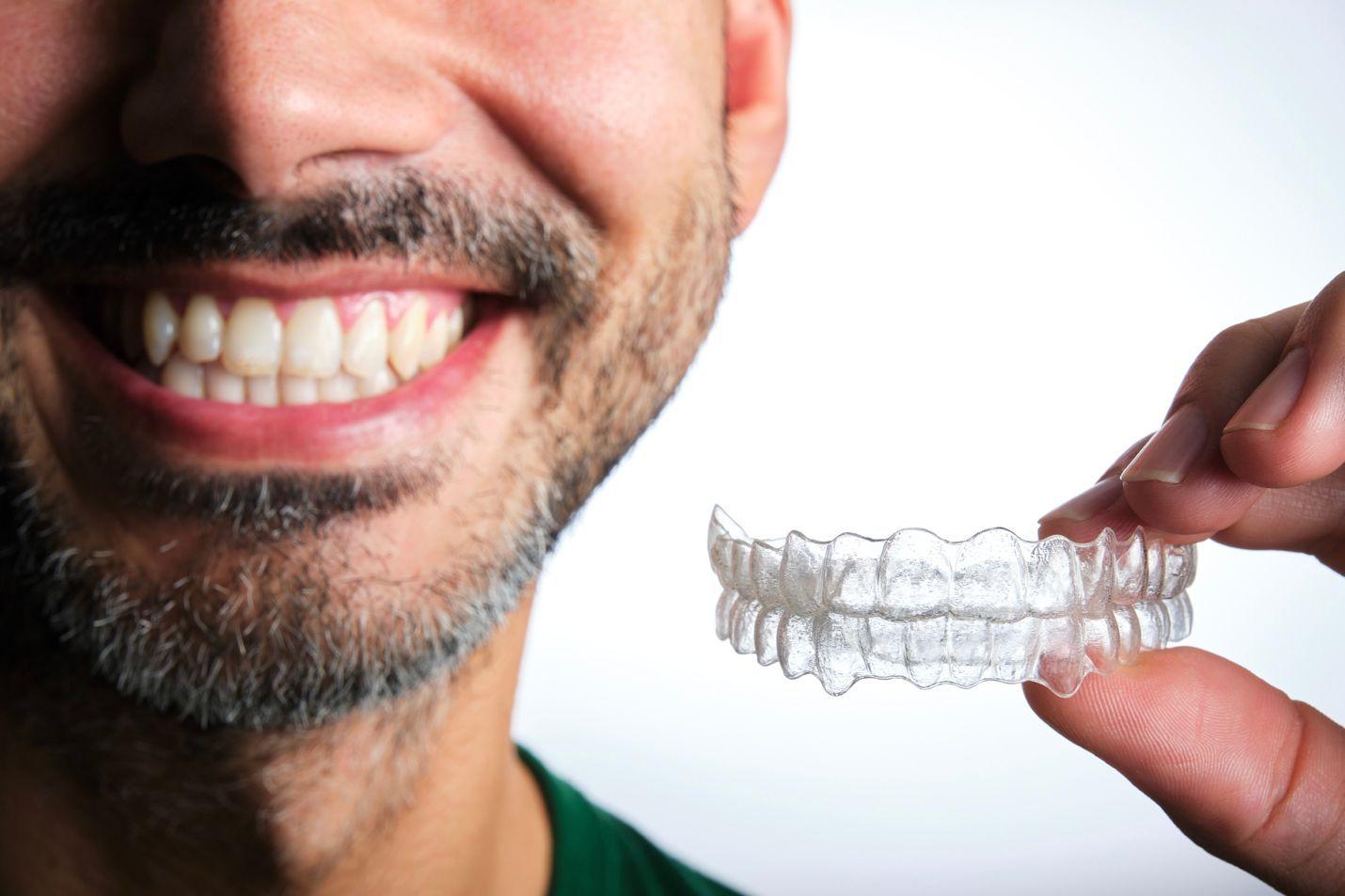 Crossbite Teeth: Causes and How to Treat It?