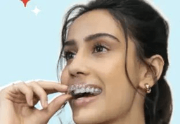 Toothsi Aligners Price - Invisible Teeth Braces Cost in India