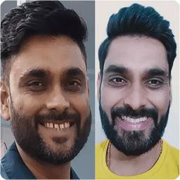 toothsi Reviews, Customer Teeth Treatment Results & Feedback | makeO ...