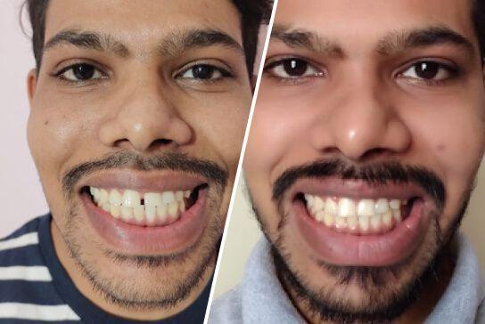Best Oral and Skin Care Solutions in India | makeO